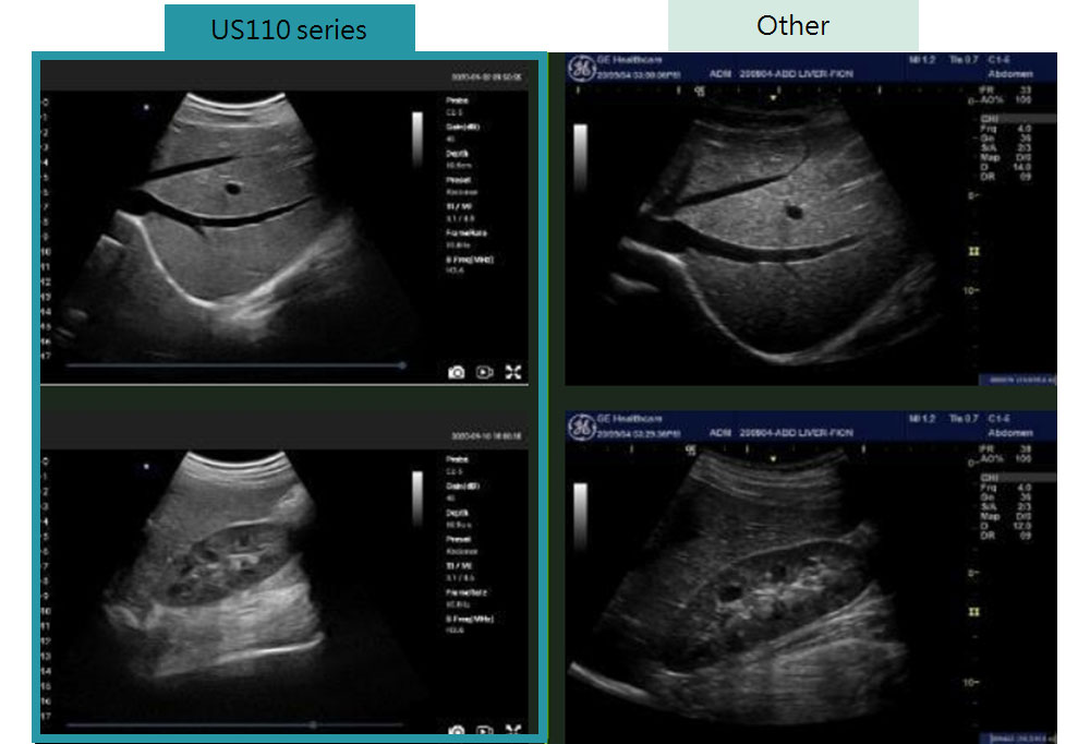 Wireless Handheld Ultrasound - Hukui Biotechnology Co., Ltd